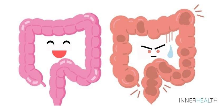 Does Colon Cleansing Actually Work? – Inner Health Clinic